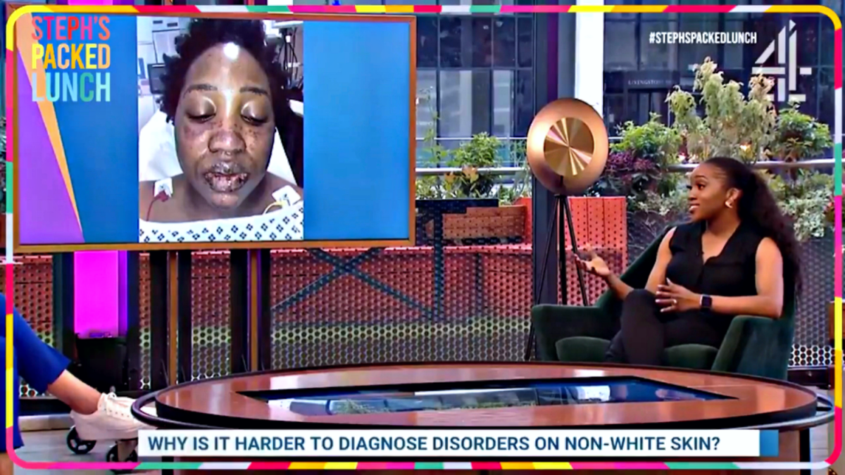 CHANNEL 4 (LIVE) INTERVIEW – WHY IS IT HARDER TO DIAGNOSE DISORDERS ON ...